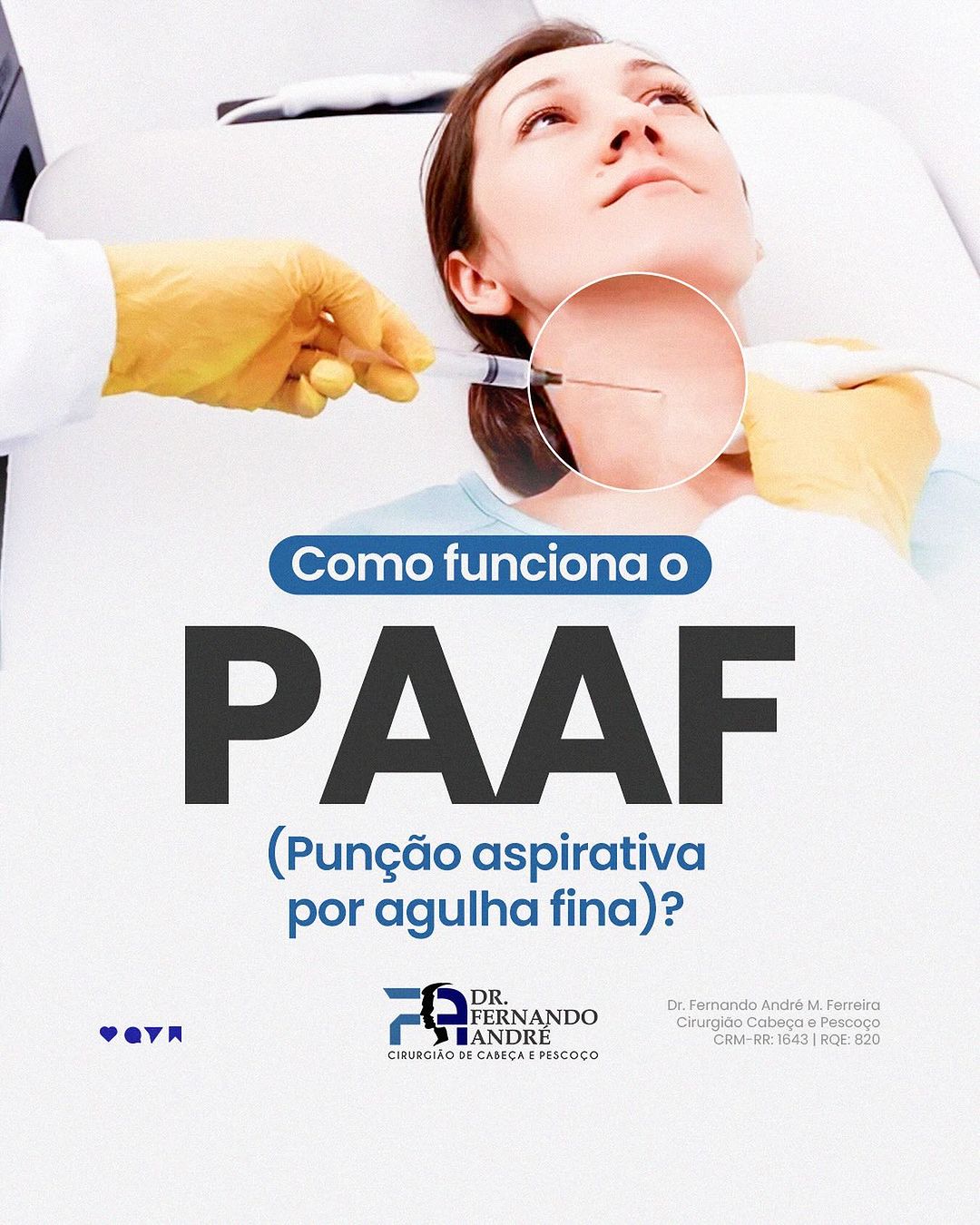 A Punção Aspirativa por Agulha Fina (PAAF) é um procedimento utilizado ...