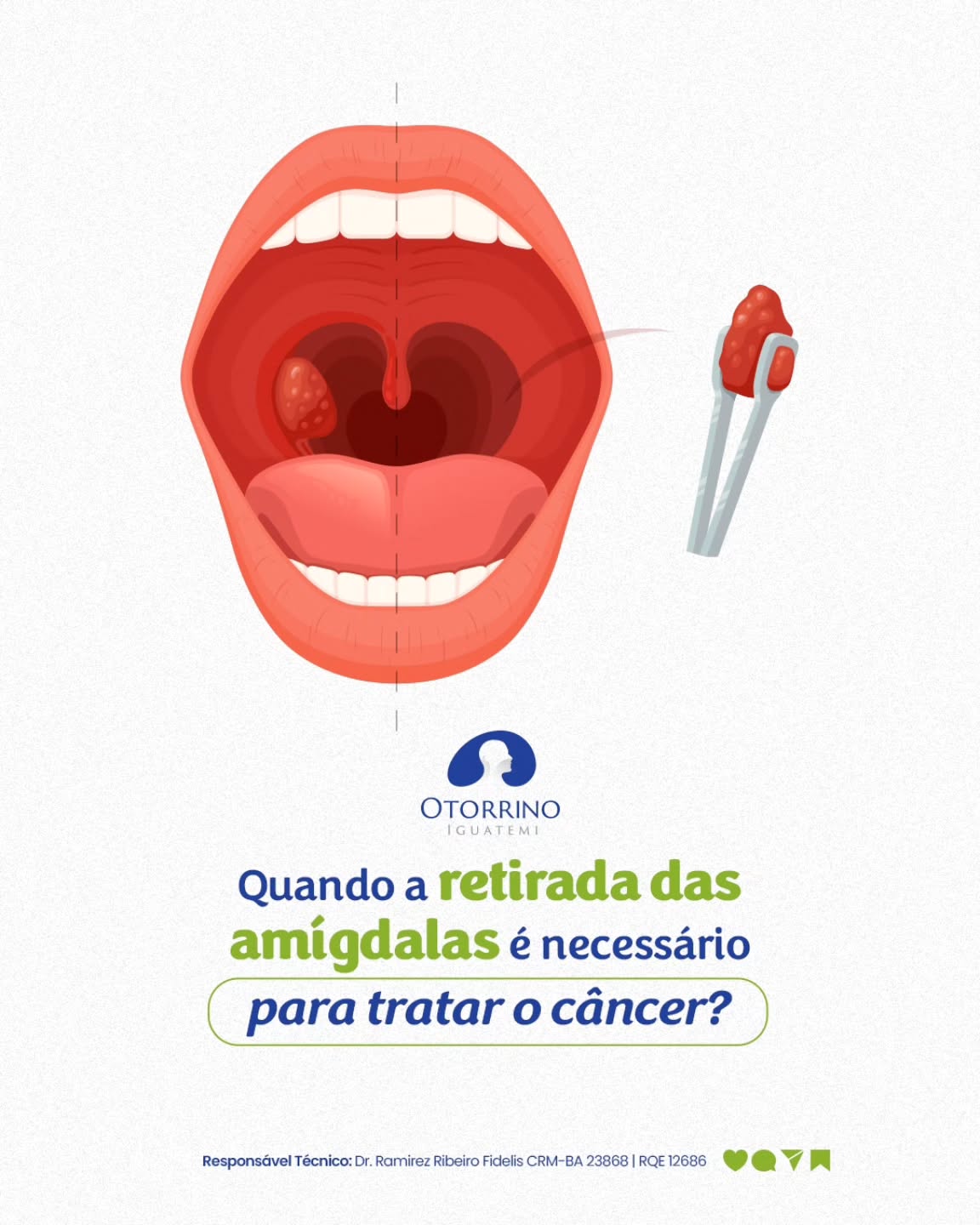 Você sabia que as amígdalas, que estão localizadas na parte de trás da ...