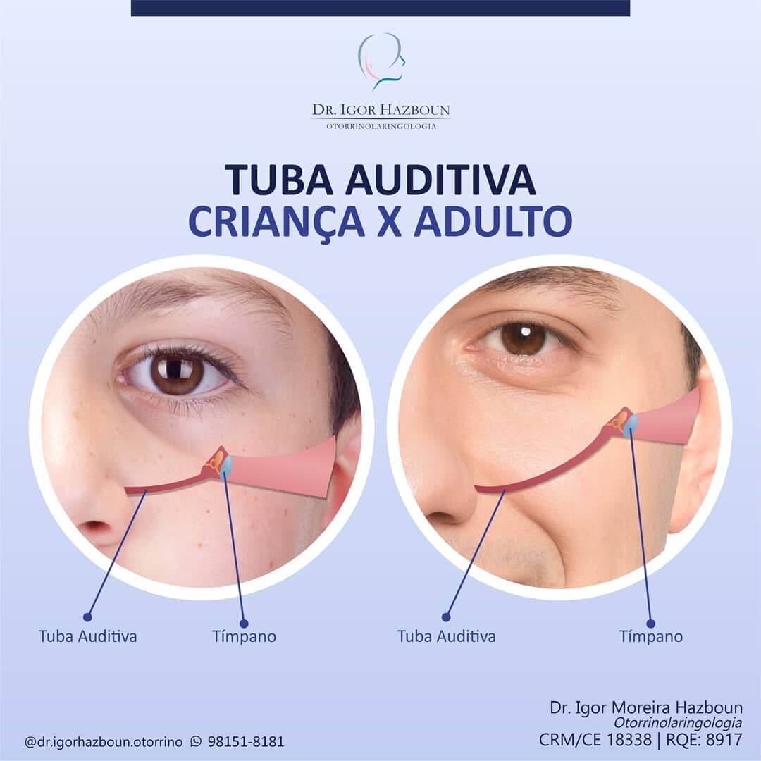 Tuba Auditiva In English at Isabel Spiegel blog