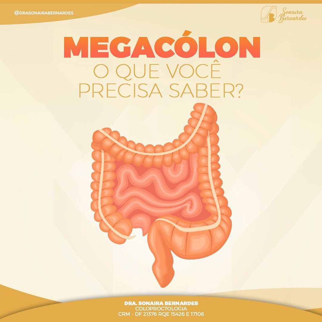 Megacólon o que é preciso saber?