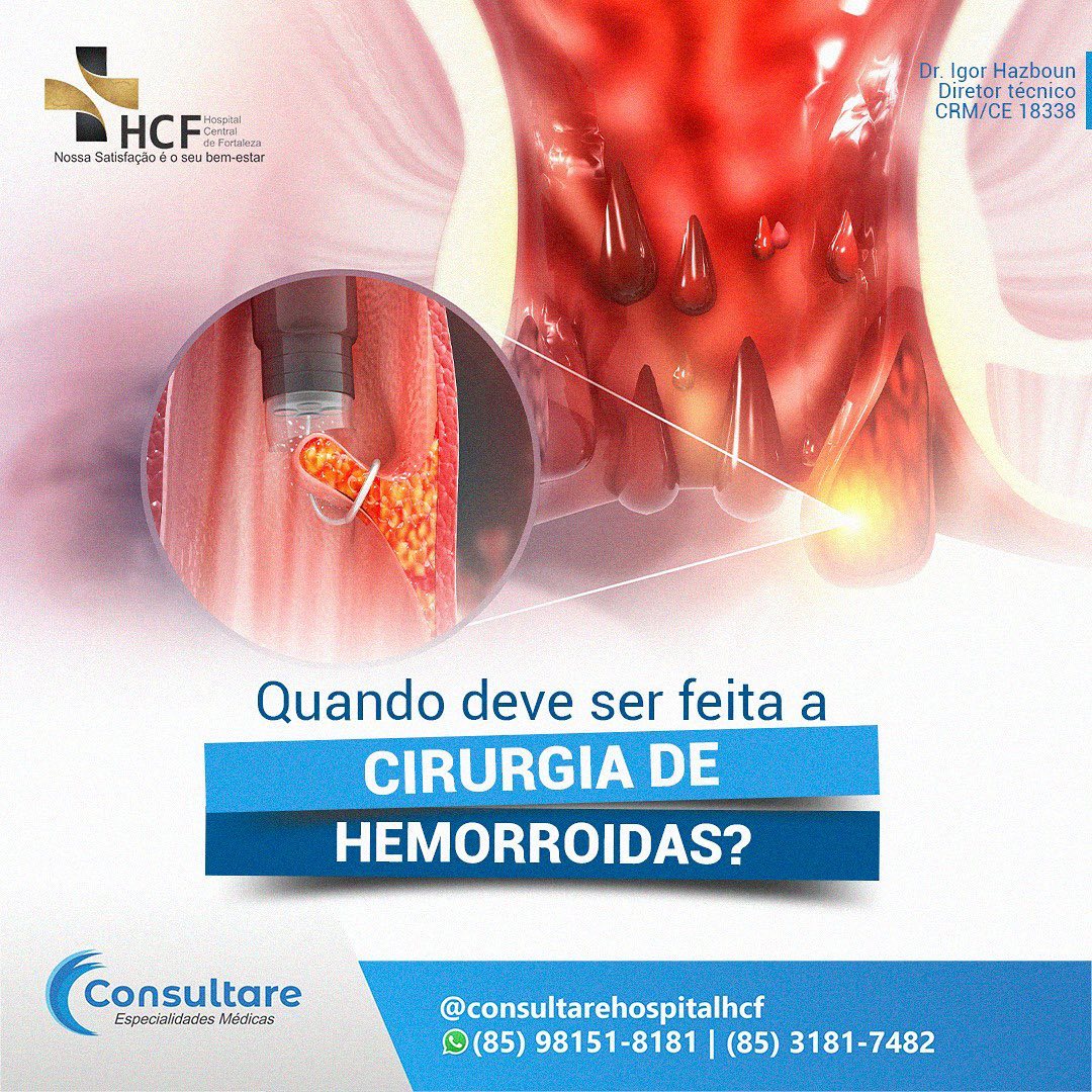 O que causa hemorroida e como tratar?